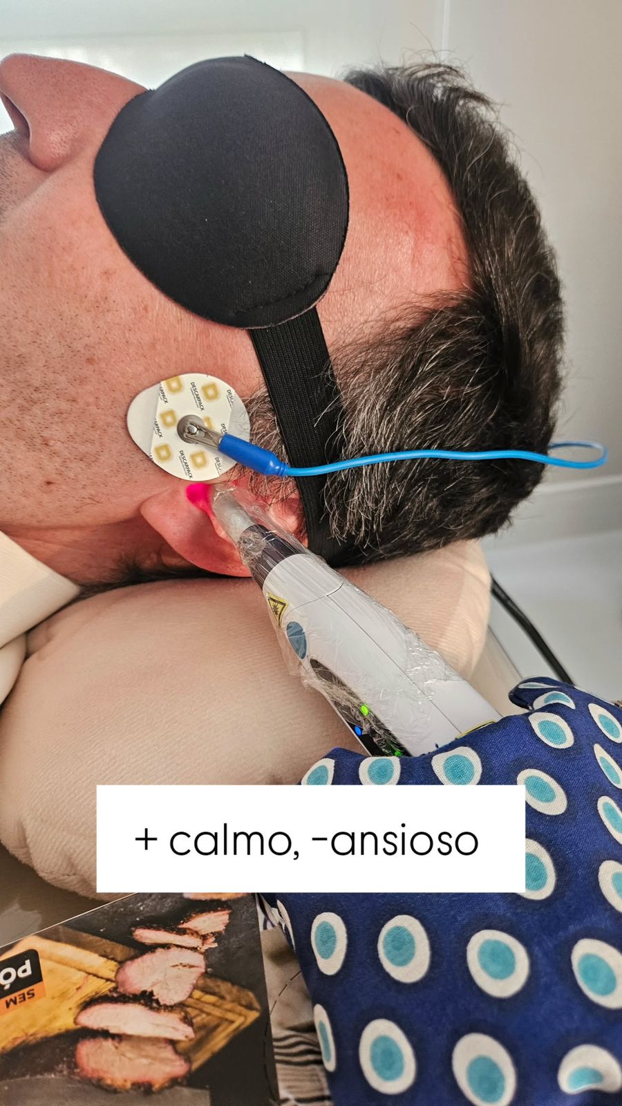 Pacientes Zumbido em Tratamento: Therapy Zumbido